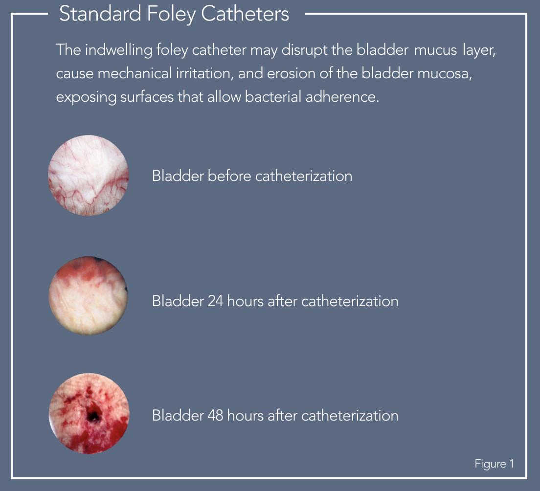 Indwelling - HR Healthcare